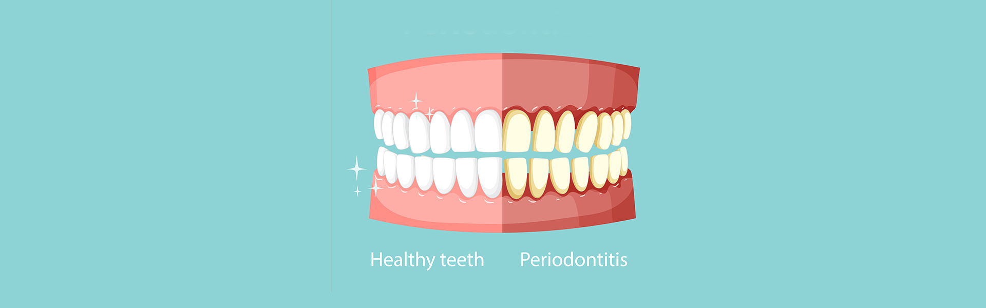 Understanding the Importance of Periodontics in Maintaining Oral Health ...